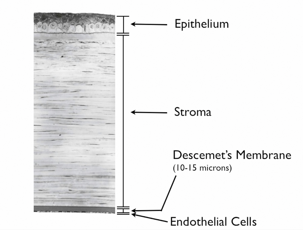 Corneal Transplant Surgery in Louisville, KY